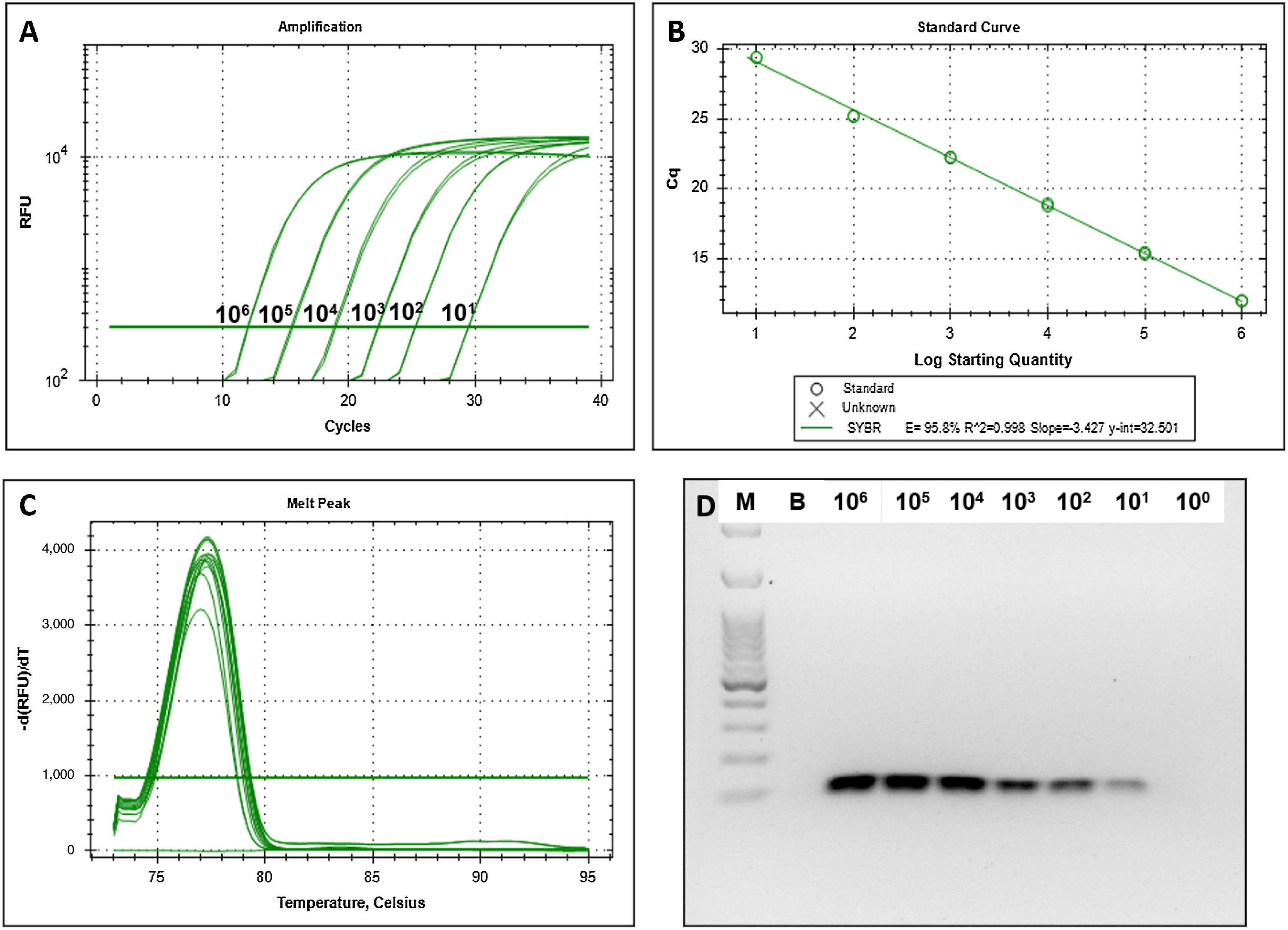 Bacterial load comparison of enteroaggregative Escherichia coli (EAEC ...
