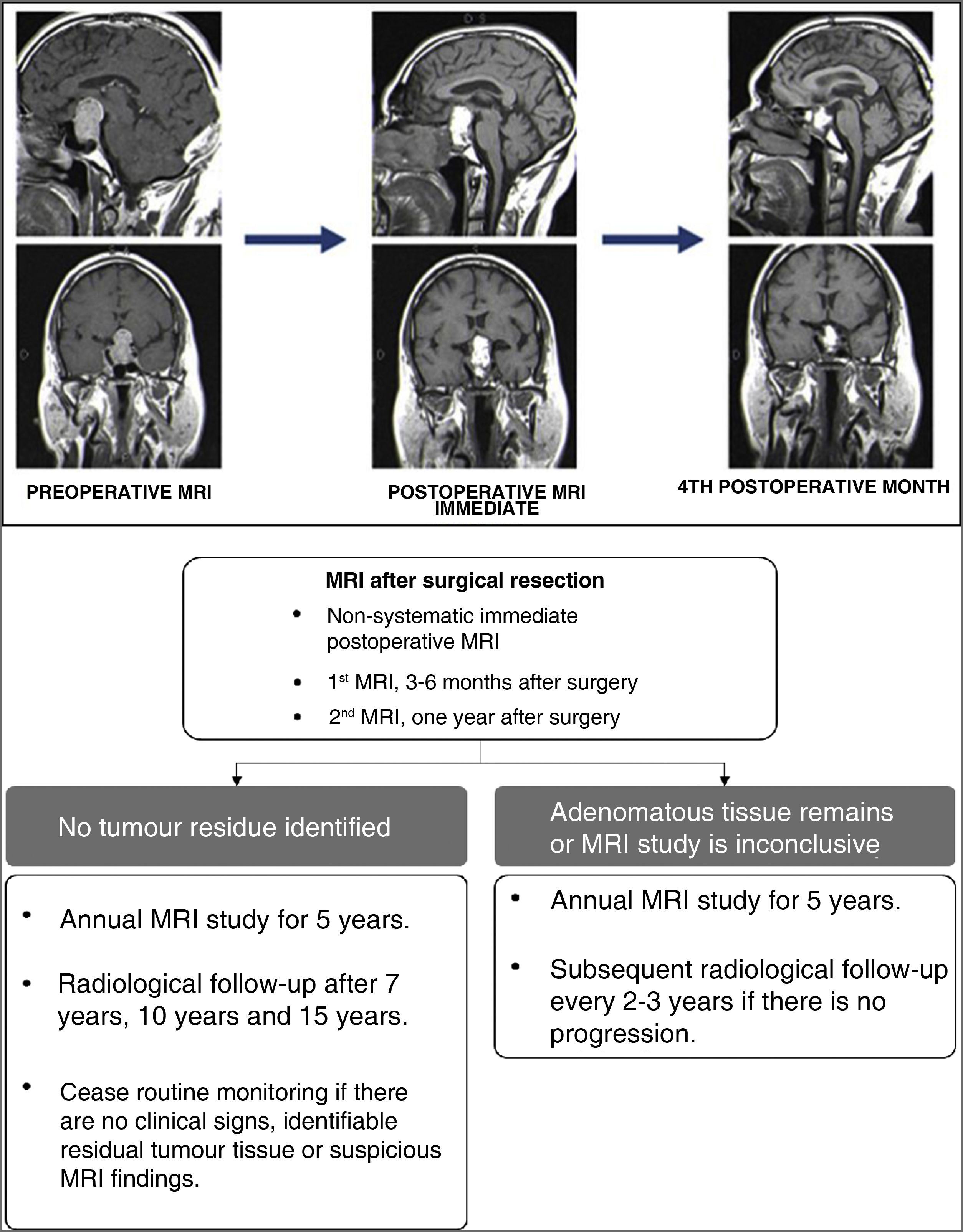 hypothalamus mri protocol
