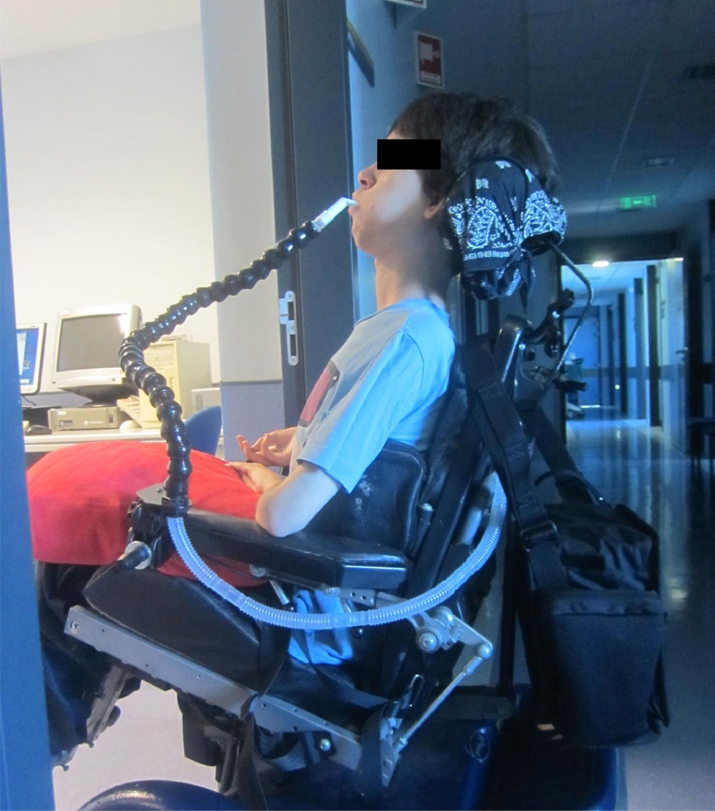 Continuous noninvasive ventilatory support outcomes for patients with ...