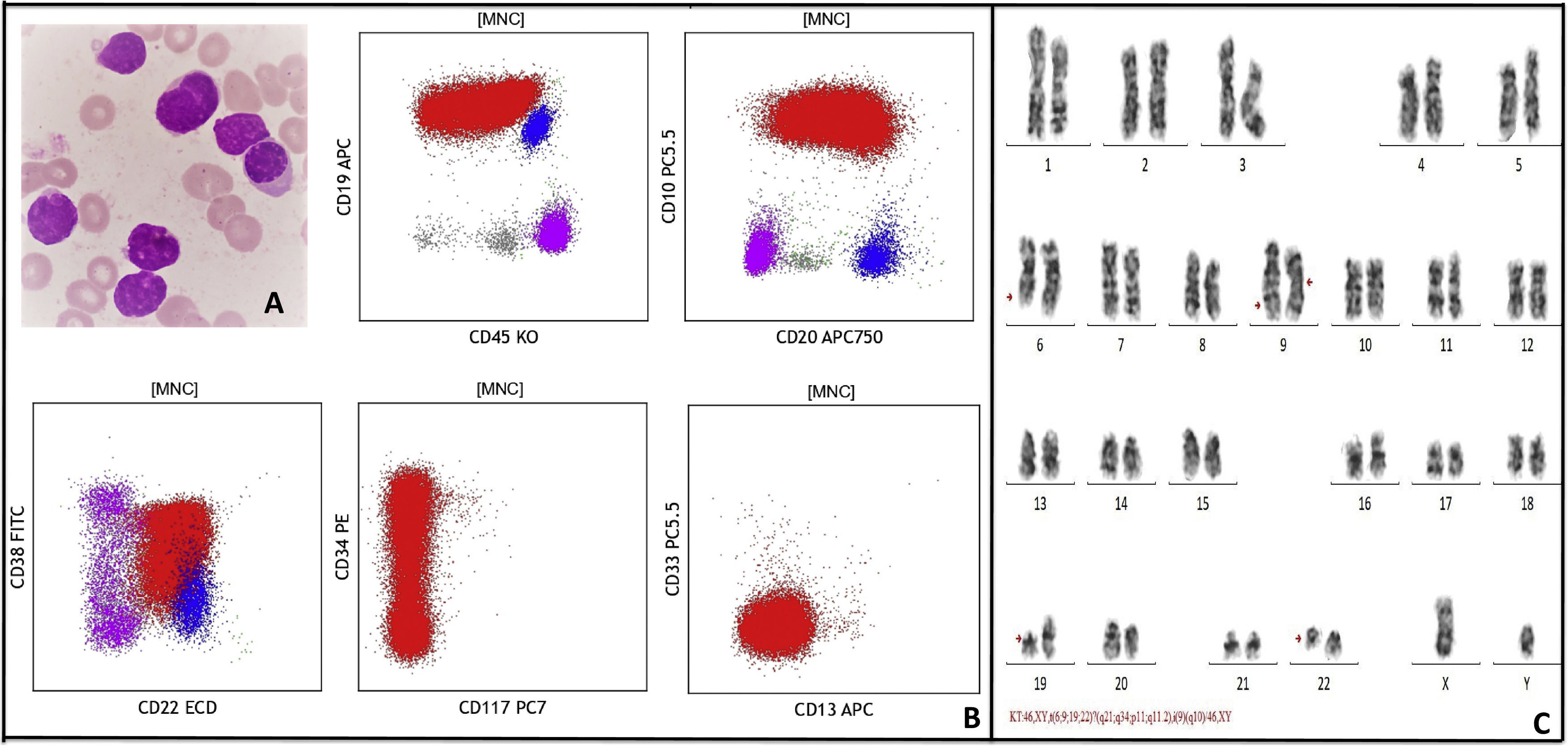 An interesting case of chronic myeloid leukemia with twists and turns ...