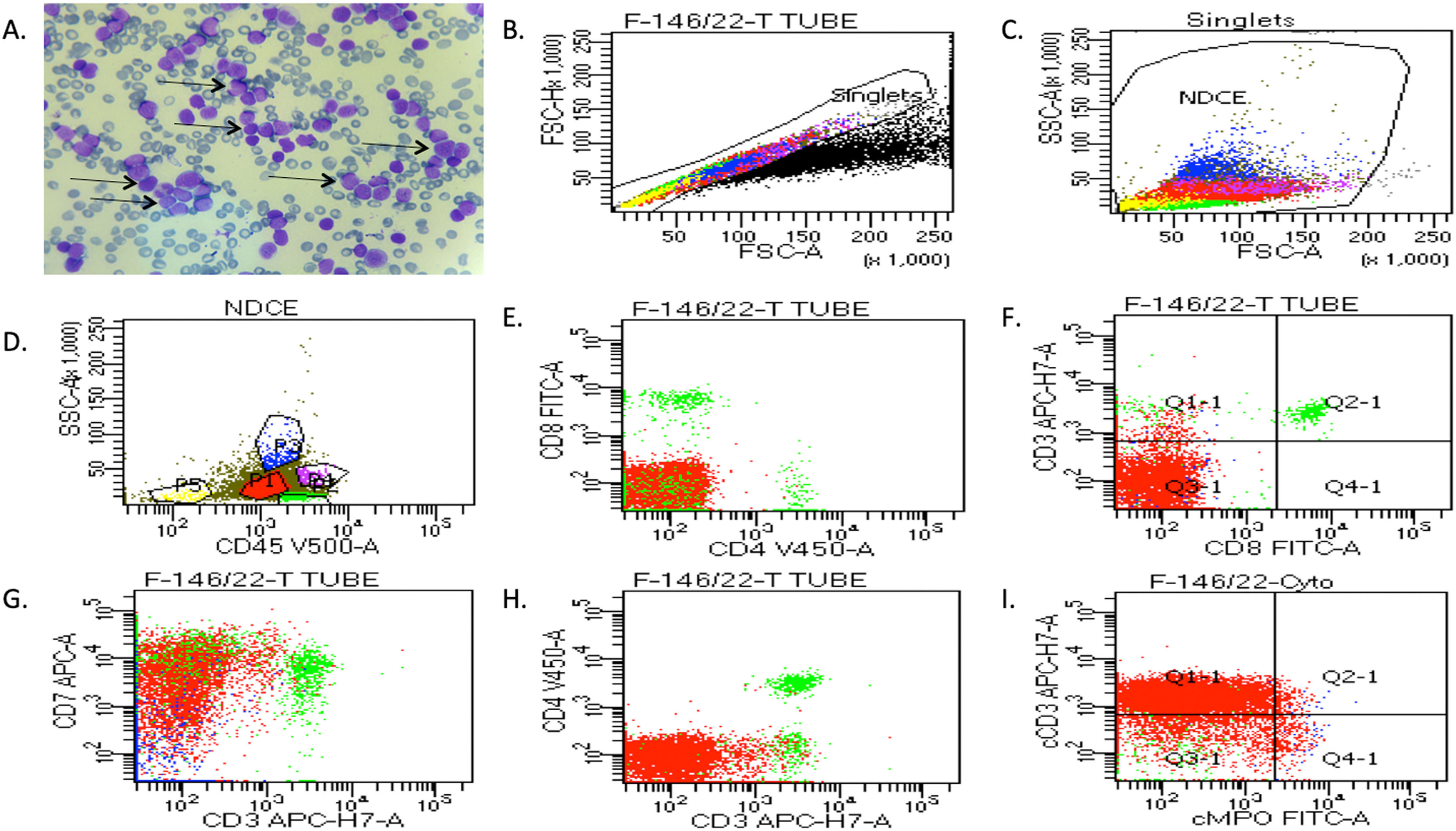 Exploring novel protein biomarkers for early-stage diagnosis and ...