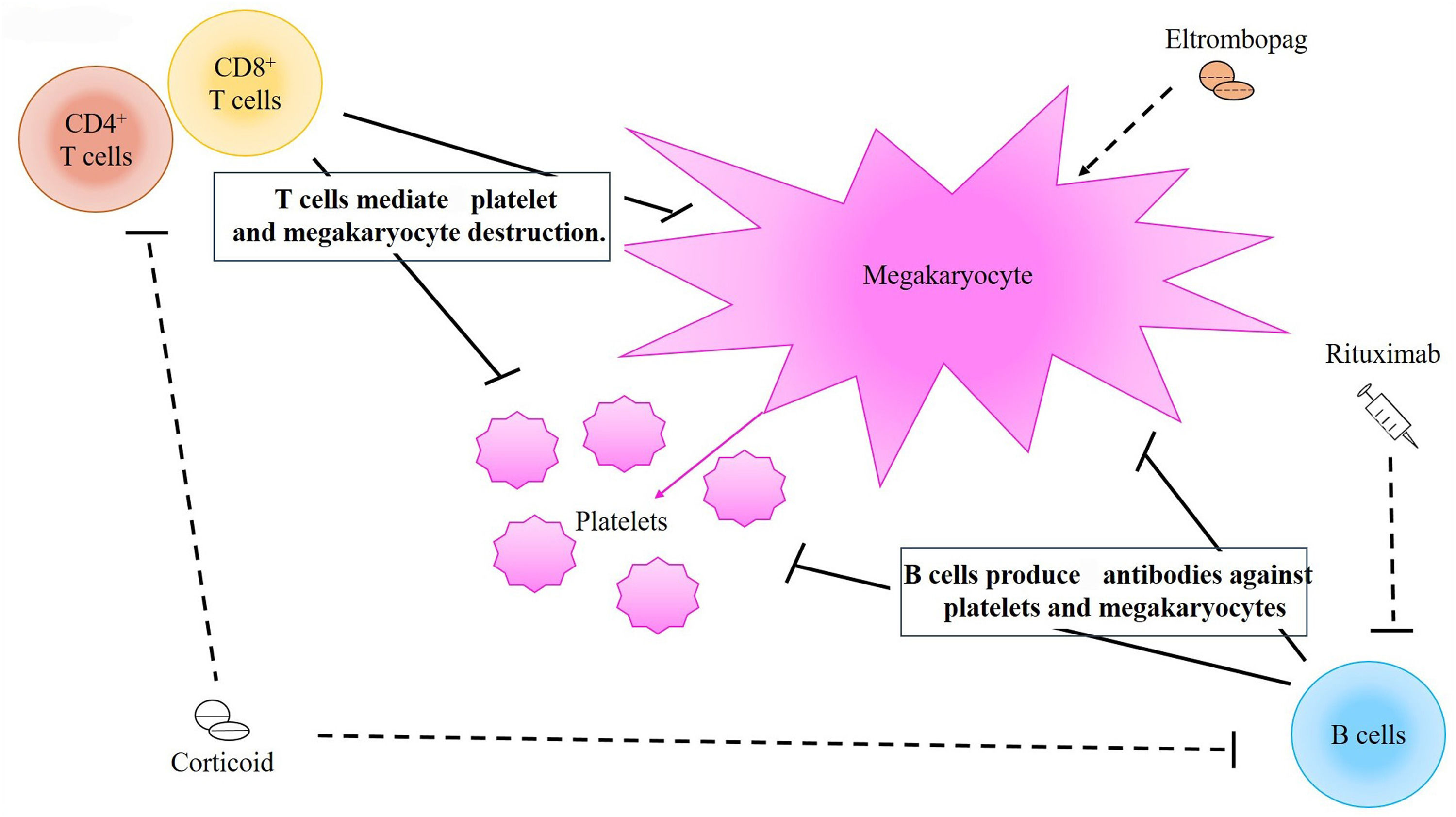 Refractory immune thrombocytopenia responding to combination therapy of ...